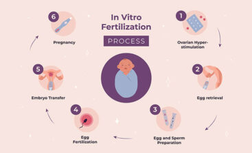 A Guide to the IVF Process & Timeline | Best IVF centre in Delhi