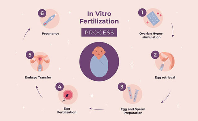 A Guide to the IVF Process & Timeline | Best IVF centre in Delhi
