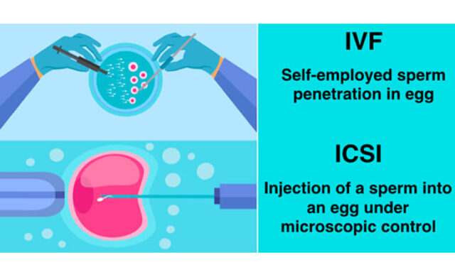 IVF Treatment in Delhi - All That You Need to Know | Dr Rhythm