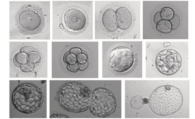 IVF Treatment in Delhi - All That You Need to Know | Dr Rhythm