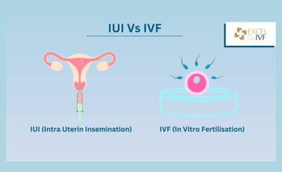What's The Difference Between IUI And IVF?