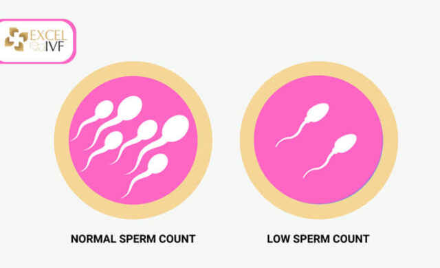 Getting Pregnant with A Low Sperm Count | Dr Rhythm Gupta