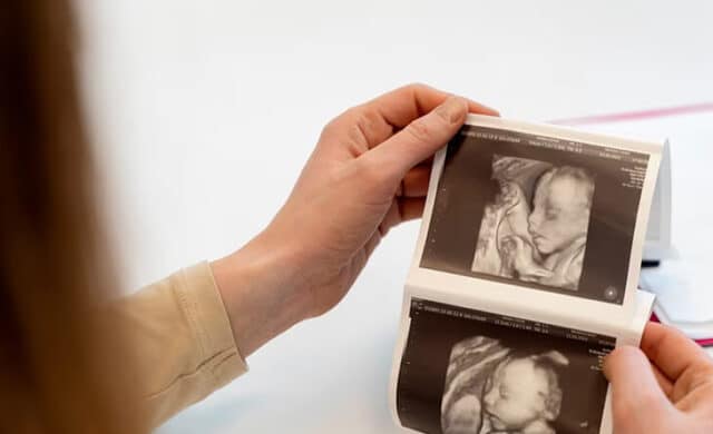 Home Pregnancy Test After IVF Embryo Transfer
