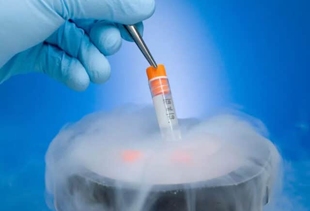Ovarian Tissue Freezing for Fertility - A Complete Guide